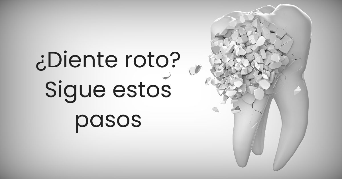 Cómo arreglar un diente roto: conoce las restauraciones - Clínica ...