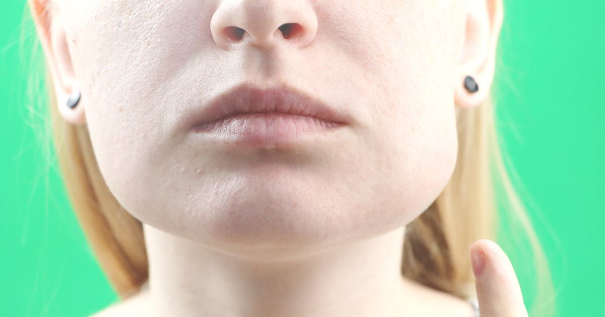 Necrosis Pulpar: Qué es, Síntomas y ¿Tiene Solución? - Clínica Dental ...